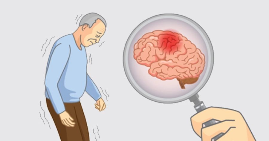 Am I At Risk For Alzheimer Disease?-testname